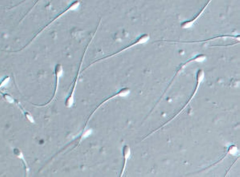 Assisted and advanced reproductive techniques in sport horse breeding ...
